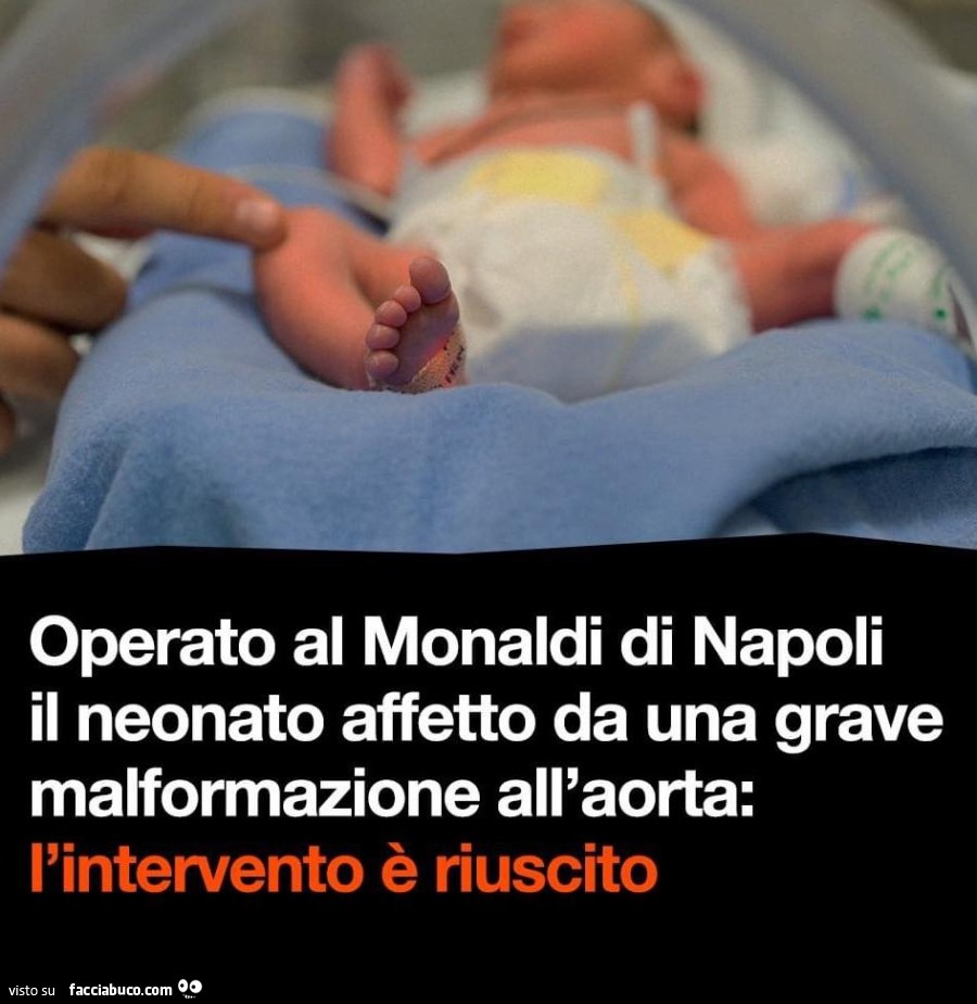 È stato operato all'Ospedale Monaldi di Napoli il neonato di 10 giorni ...